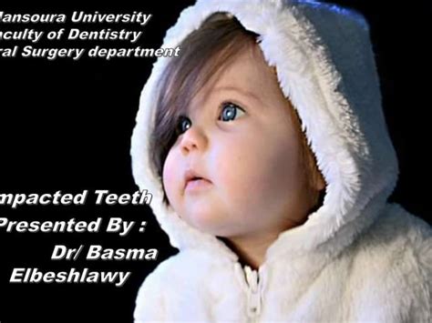 31embedded And Impacted Teeth Pptx