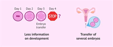 Day 3 Embryo Transfer Disadvantages