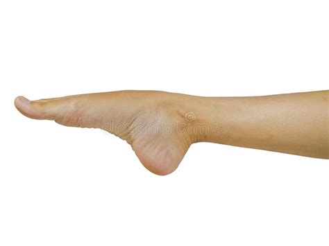 A Woman S Feet On Tiptoes Or In A Ballerina Pose Isolated On A White