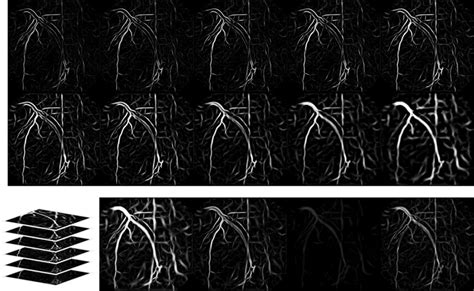Multi Scale Filtering With Frangi Filter Upper Panel And The
