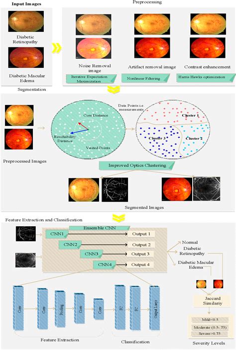 Figure 1 From Diabetic Retinopathy And Diabetic Macular Edema Detection Using Ensemble Based