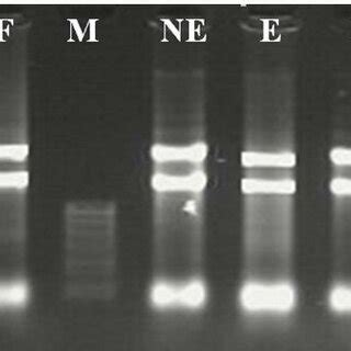 Confirmation Of RNA Quality The Quality Of RNA Samples Was Confirmed Download Scientific