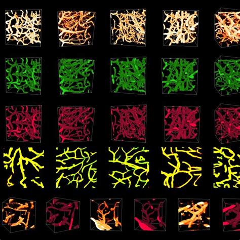 Segmentation Results Of The Tek Dataset The Overlap Output In The