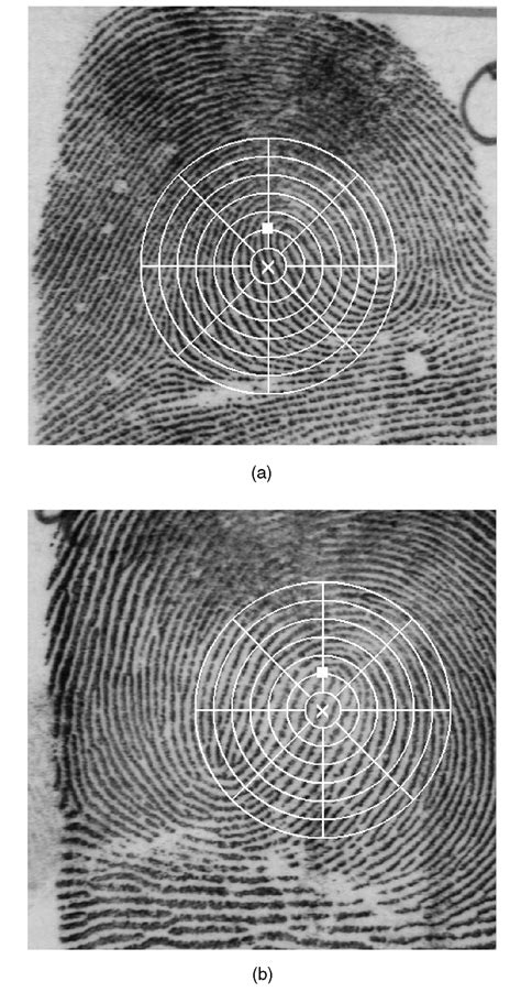 Misclassification Of Whorl Twin Loop As A Right Loop B Left Loop Download Scientific