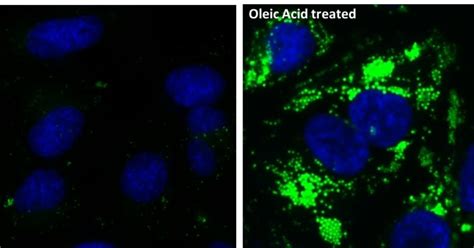 AAT Bioquest Staining Lipids