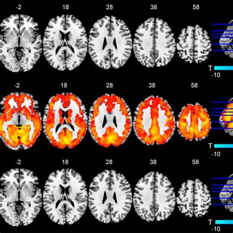 Sex Difference T Value Of The Two Sample T Test Of A Ben B Cbf And