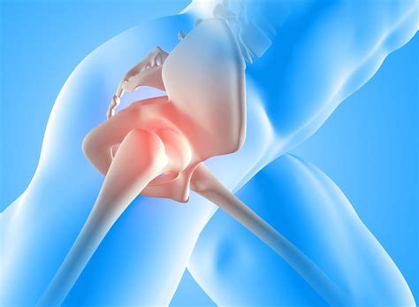 New Advances In Minimally Invasive Hip Surgery