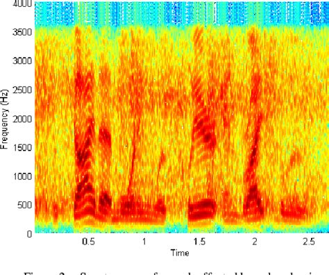 figure 1 from an improved multi band speech enhancement method for