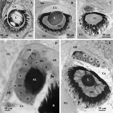 Light Micrographs Of Nearly Longitudinal Serial Sections A E Showing