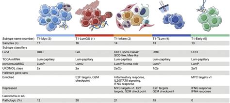 Aua 2023 Very High Risk Nmibc Radical Cystectomy Or Intravesical Therapy