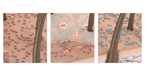 Base Hairdressing Scalp Clinix Hairdressers In Warrington