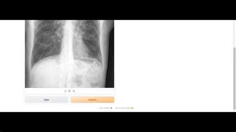 Medical Report Generation YouTube