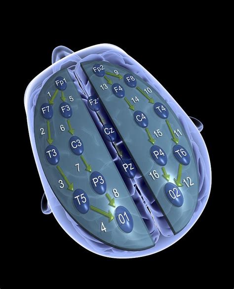 EEG Electrodes On Head Artwork Photograph By Science Photo Library Fine Art America