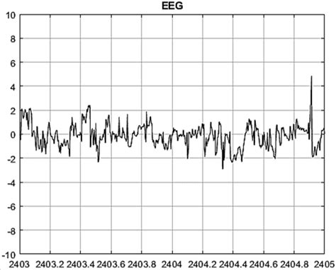 Clean EEG Signal For A Short Duration Download Scientific Diagram