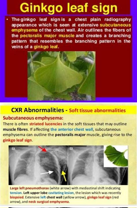 Ginkgo Leaf Pattern Adalah