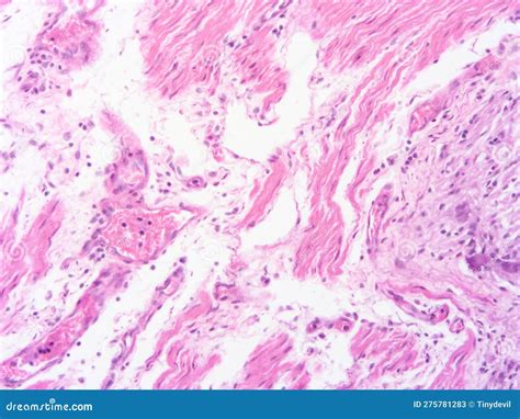 Picture Of Histology Human Tissue With Microscope From Laboratory Not Illustration Designation