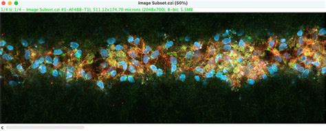 Oppening Czi Files Does Not Display Colorized And Superimposed