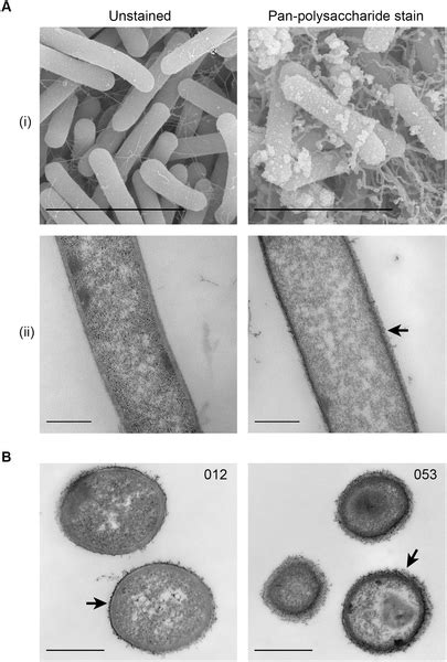 Clostridium Difficile Spore Stain