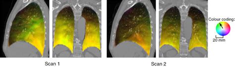 Illustration Of Inter Fraction Motion Differences Left Visualisation Download Scientific