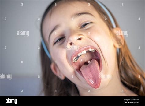 Open Her Mouth Meaning At Marvin Goff Blog