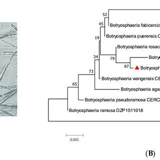 Hypha A And Phylogenetic Tree B Of Bot Dothidea JNHT The Fungal Download Scientific