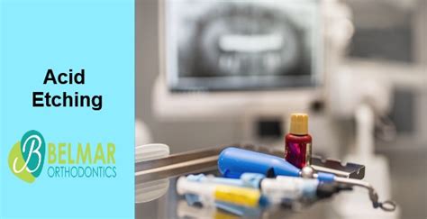 What Is Acid Etching Belmar Orthodontics What Is Acid Etching Belmar Orthodontics