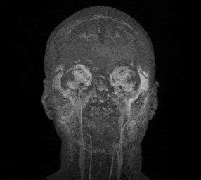 Mri Tag PrimoGIF