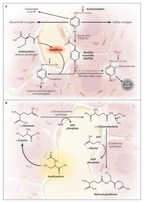 Acetylcysteine For Acetaminophen Poisoning Nejm