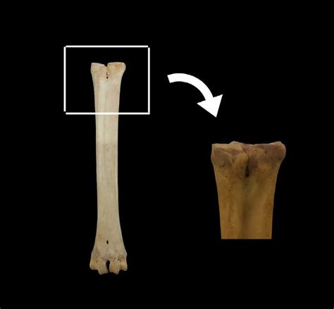 Metacarpal Proximal Morphology A The Lateral Epicondyle Is Confined