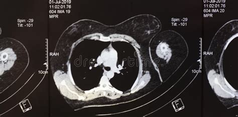 Magnetic Computer Tomography Stock Image Image Of Machine Science 320024923
