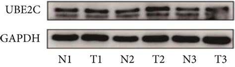 Ube2c Was Upregulated In Oscc A The Mrna Level Of Ube2c In Tcga Oscc