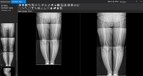 Xeus Imaging Workstation Minnovaa
