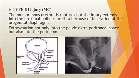 Rgu And Mcu Procedure And Interpretation In Commonly Encountered