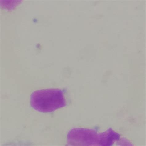Malaria Object Detection Model By Malaria