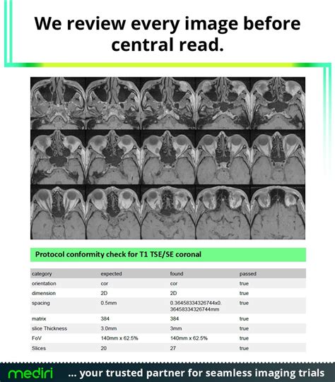 no more inconsistent image data