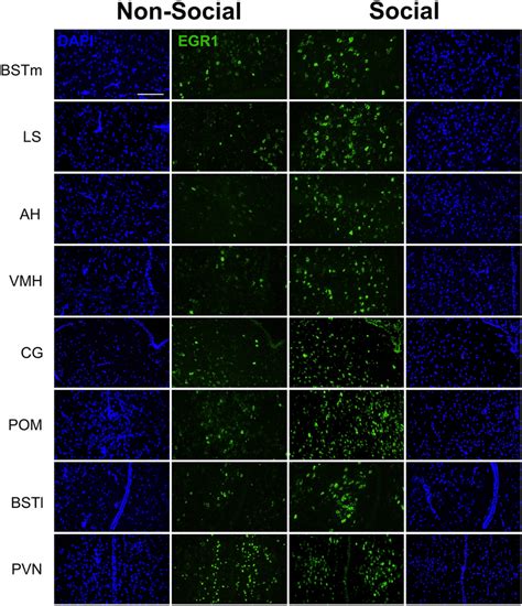 Representative Fluorescence In Situ Hybridization Images Show Regions Download Scientific