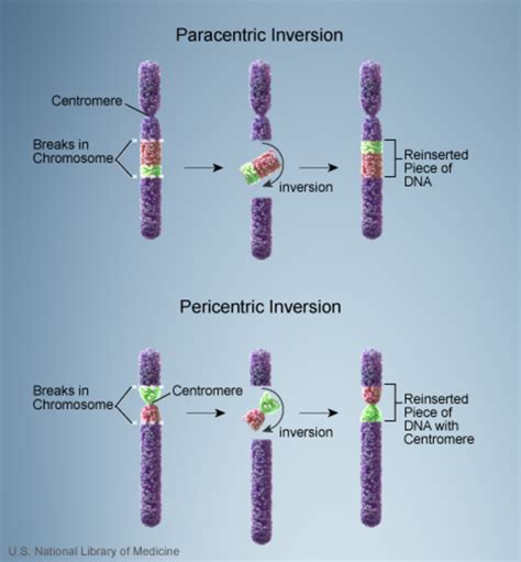 Paracentric Inversion