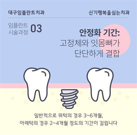 임플란트 수술 과정 및 단계별 소요 시간 신기행복을심는치과 건강정보