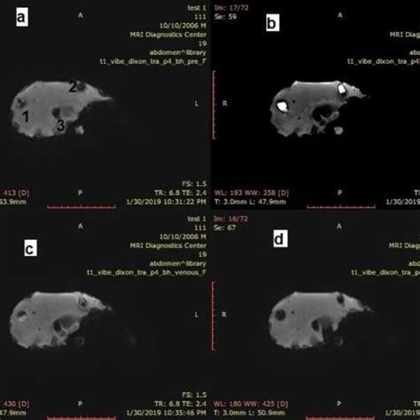 The Liver Phantom Mold A Anterior Surface B Posterior Surface Download Scientific Diagram