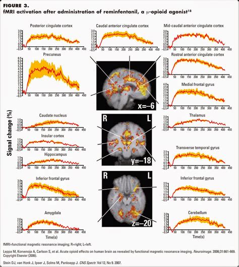 S News Opiates On The Brain