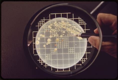 Counting Bacteria Boundless Microbiology Study Guides