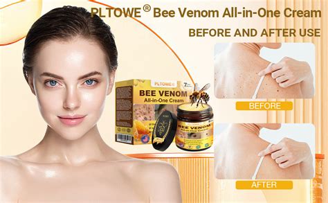 Bee Venom Benefits For Skin Tags Detroit Chinatown