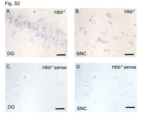 Neurons Express Hemoglobin Alpha And Beta Chains In Rat And Human Brains Abstract Europe Pmc
