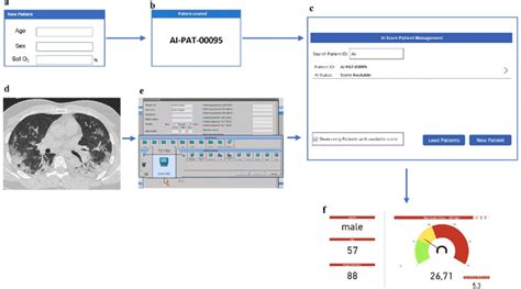 Example Of Ai Score Computation After Patients Age Sex And Oxygen