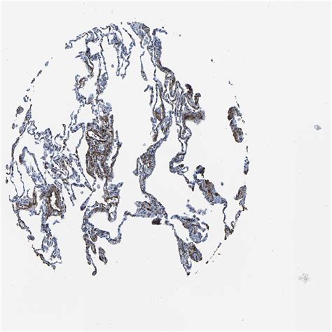 Tissue Expression Of Acta2 Staining In Lung The Human Protein Atlas