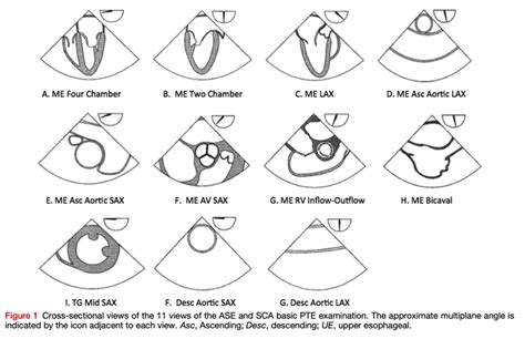 Introduction To Transesophageal Echo Basic Technique Department Of
