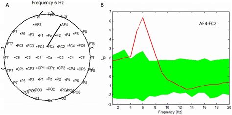 In Depressive Patients A Maximum Significance Of Phase Download