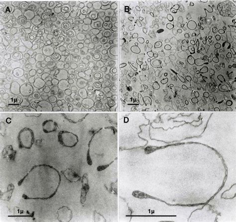 Vesicles In A Cell Micrograph