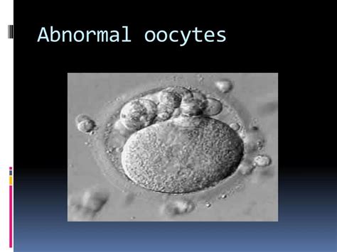 Ppt What We Do And Why We Do It Jumana Adham Husseini Lab Director