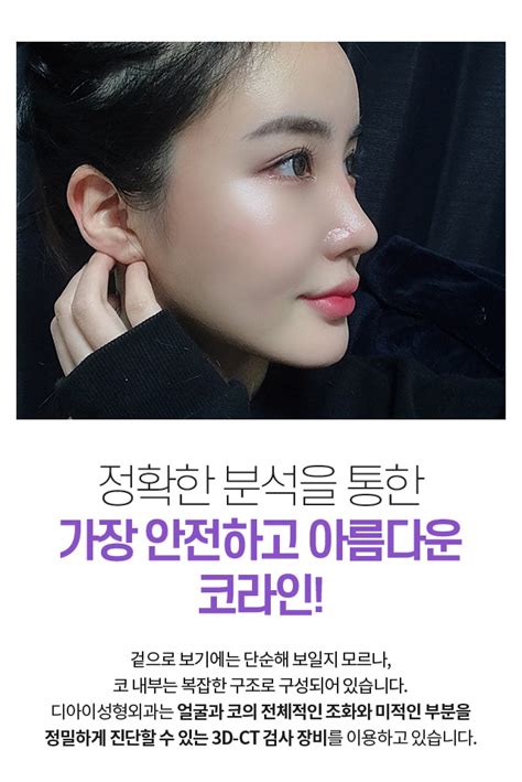 디아이성형외과